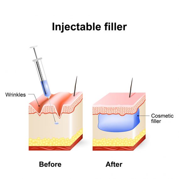 Cosmetic Injectables - Dr. Harinder S. Chahal MD