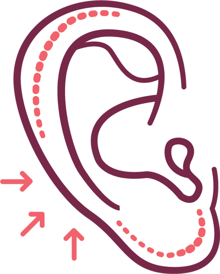 Ear Lobe Surgery - Dr. Harinder S. Chahal MD
